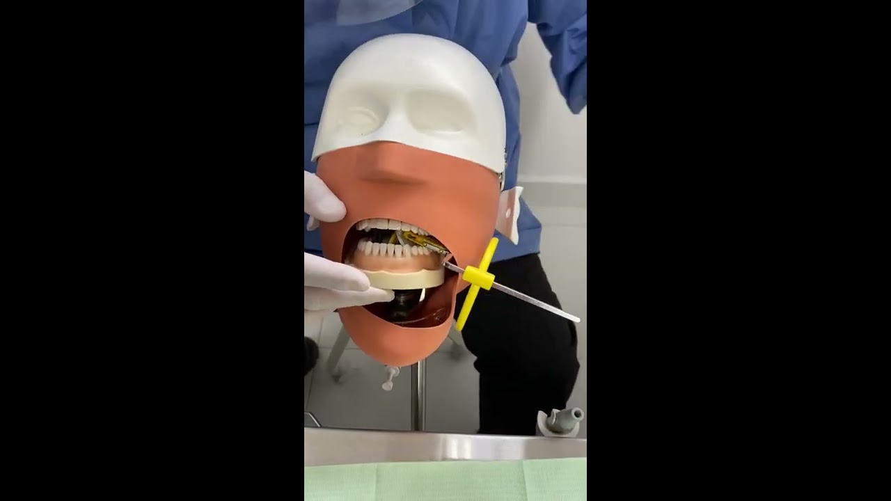 Técnica radiográfica periapical de premolares superiores derecho y ...