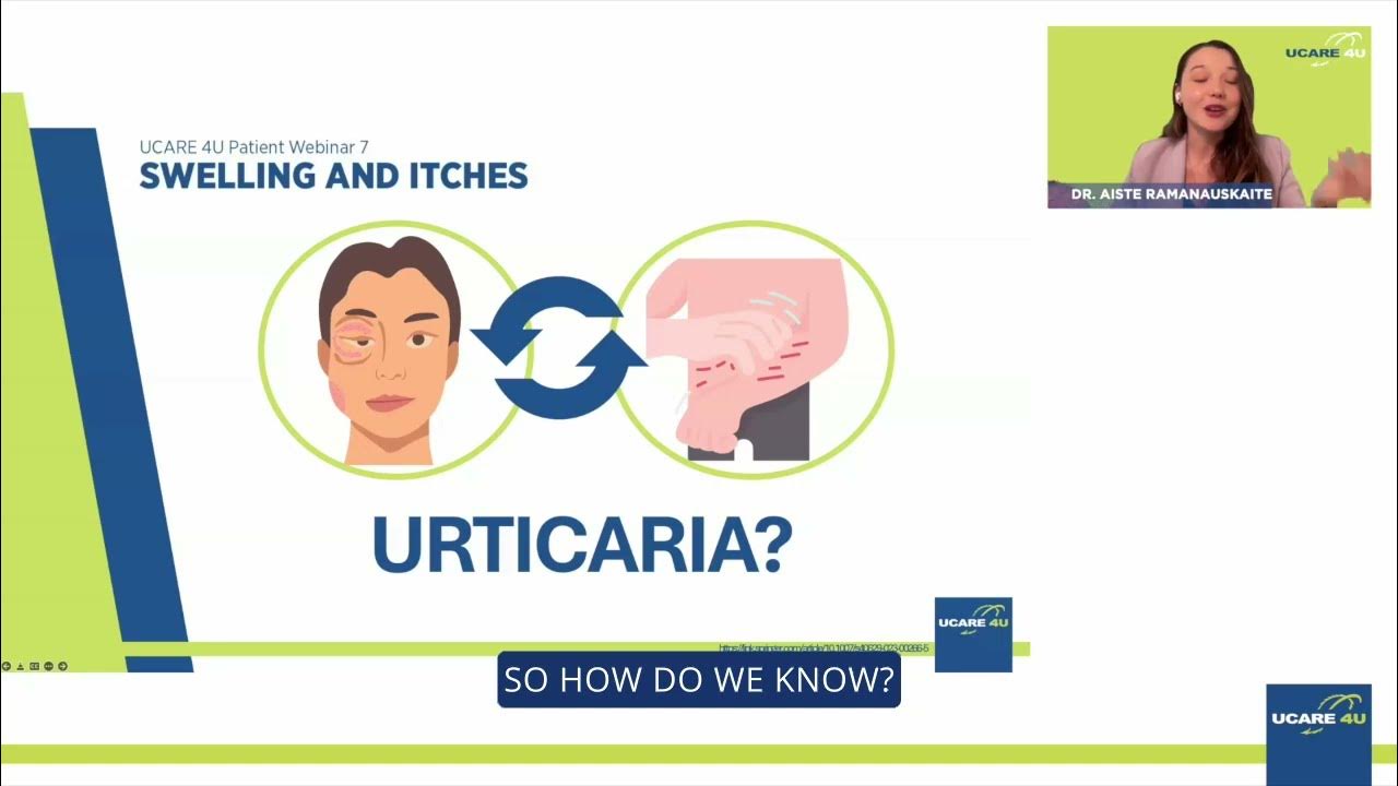 UCARE 4U Webinar No. 7_Part 1: Swelling and Itches - YouTube