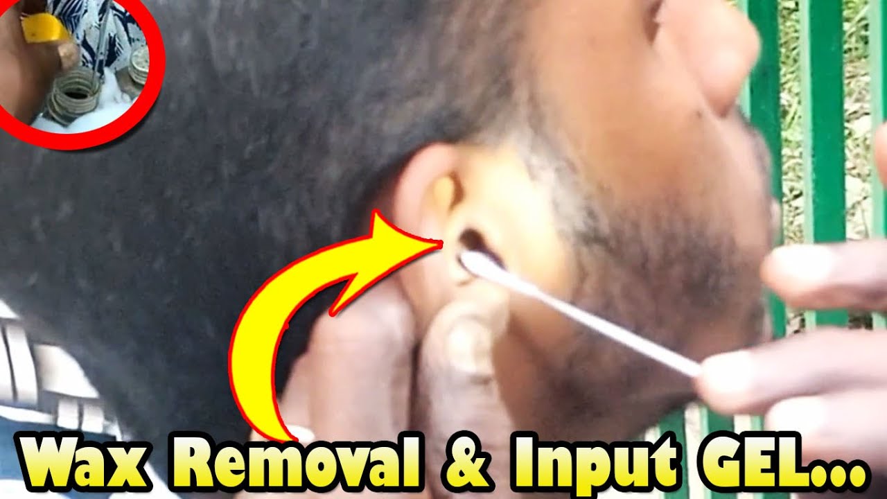 Dirt Removal with wash Ear Canal / Special Teenager Got Special Service ...