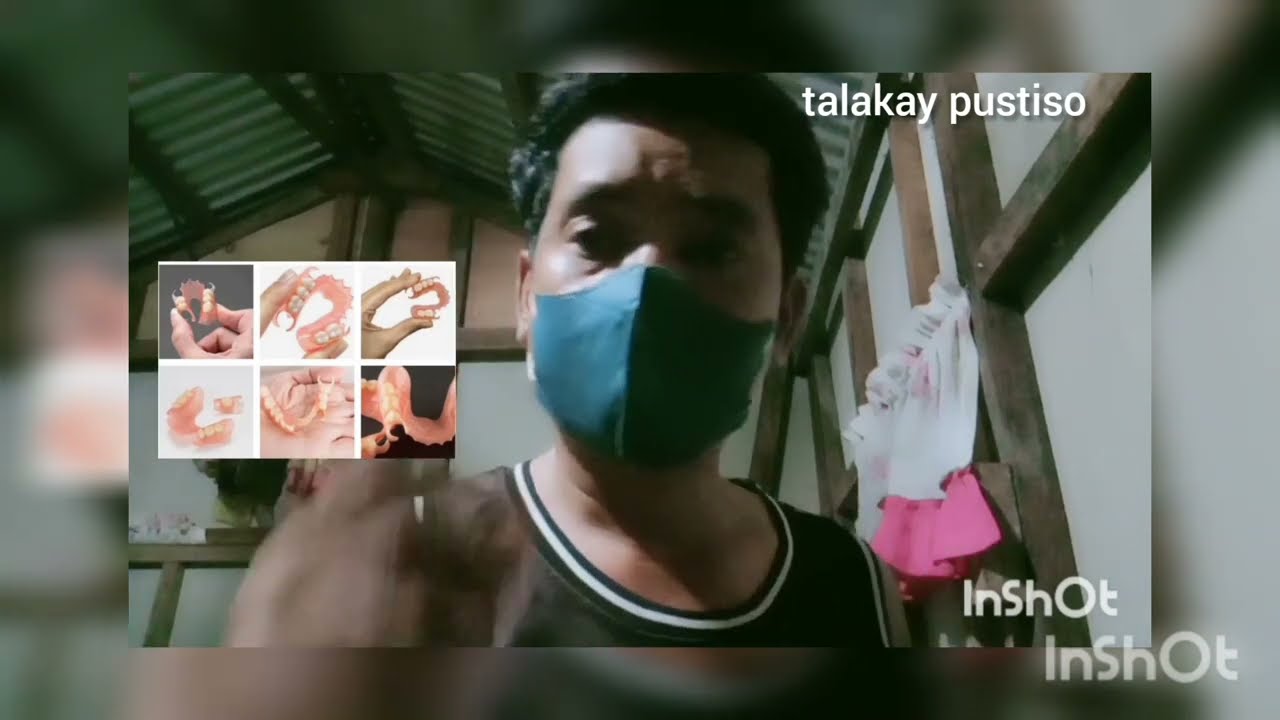 DAPAT ALAMIN BAGO MAGPAGAWA NG POSTISO | secret tips - YouTube