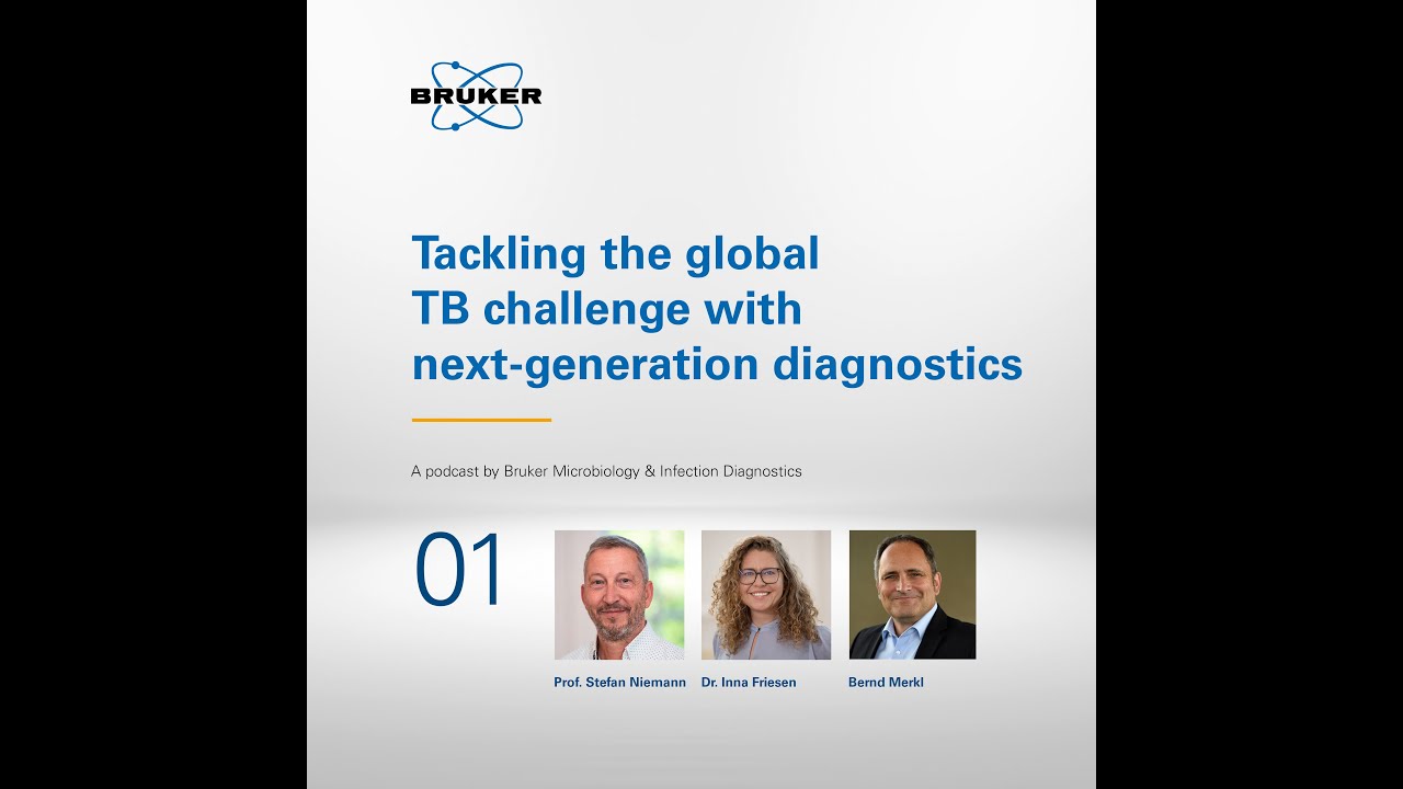 MIDialog: Tackling the global TB challenge with next-generation diagnostics - YouTube