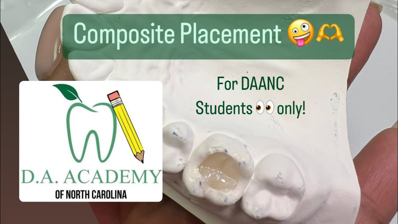 Composite Placement ! ️🤪 - YouTube