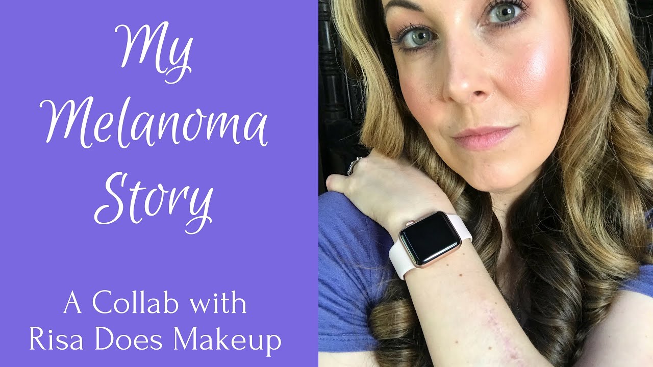 My Melanoma Story - A Collaboration with Risa Does Makeup Part I - YouTube