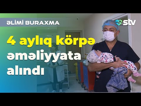 4 aylıq körpə əməliyyata alındı - Səhiyyə TV