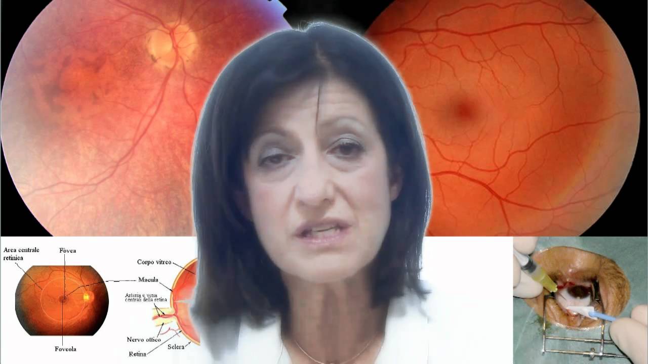 Prof Rossella Appolloni | medici.roma.it - YouTube