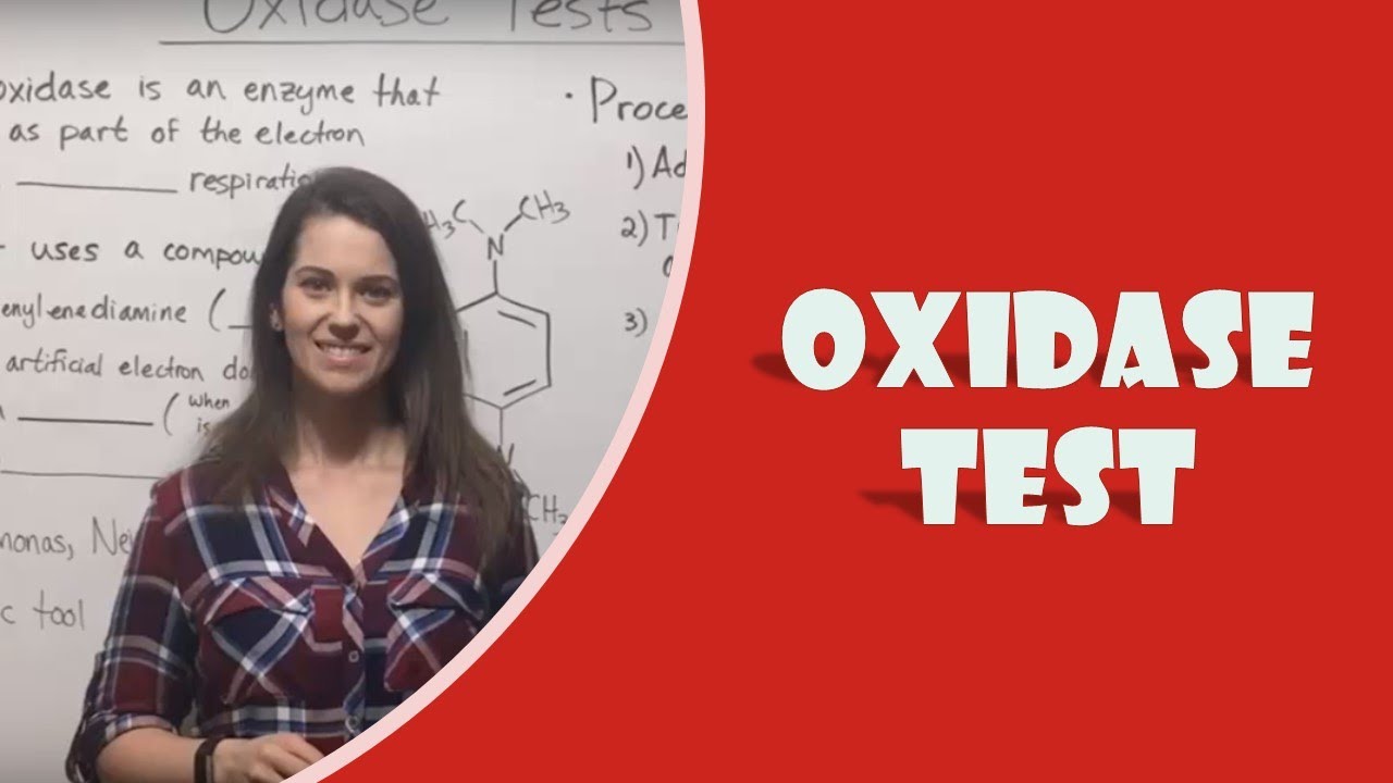 Oxidase Test - YouTube