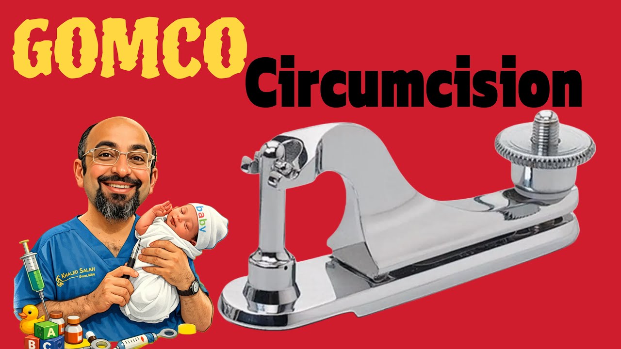 Pediatric Circumcision Using Gomco Clamp | Safe & Bloodless Technique ...