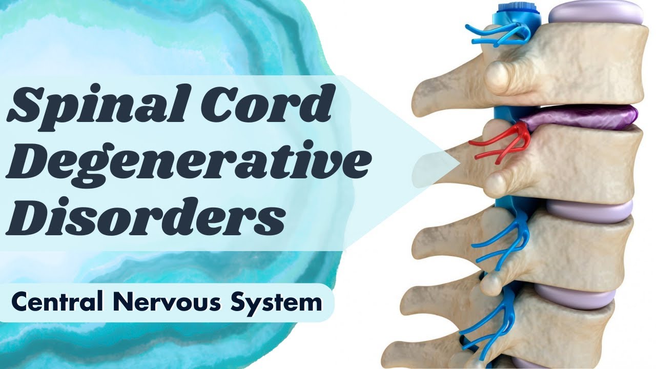 What is Spinal Cord Degenerative Disorders in Central Nervous System ...