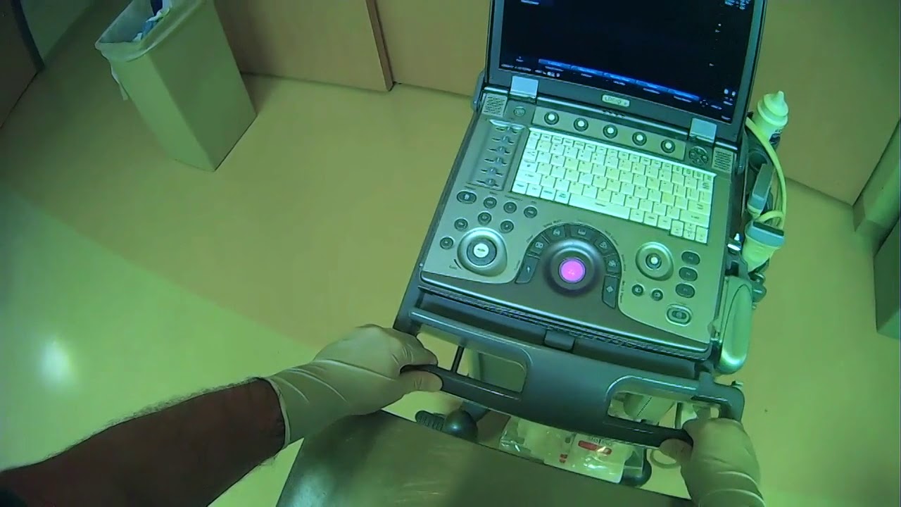 3 Positioning The Ultrasound Machine - YouTube