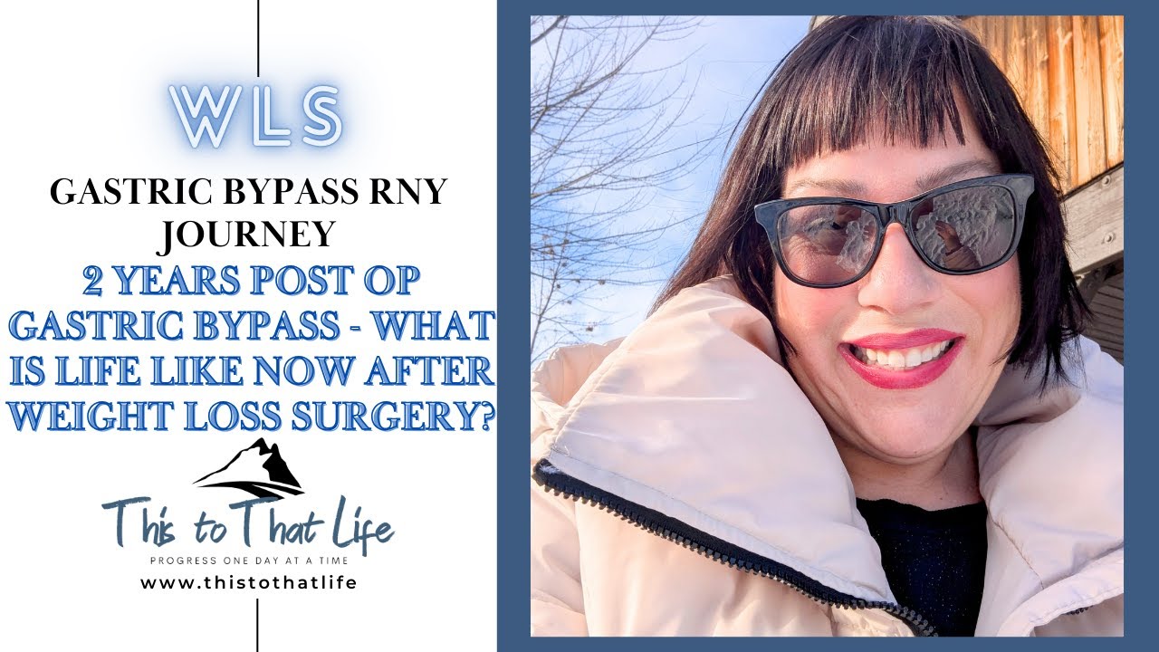 2 Years Post Op Gastric Bypass What Is Life Like Now After Weight Loss 2-years-post-op-gastric-bypass-what-is-life-like-now-after-weight-loss