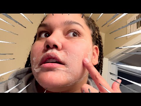 DISGUSTING PEELING SKIN PRANK ON FIANCÉ