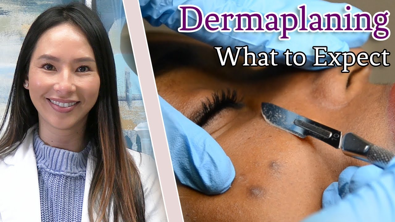 What to Expect For Your Dermaplaning Treatment - YouTube