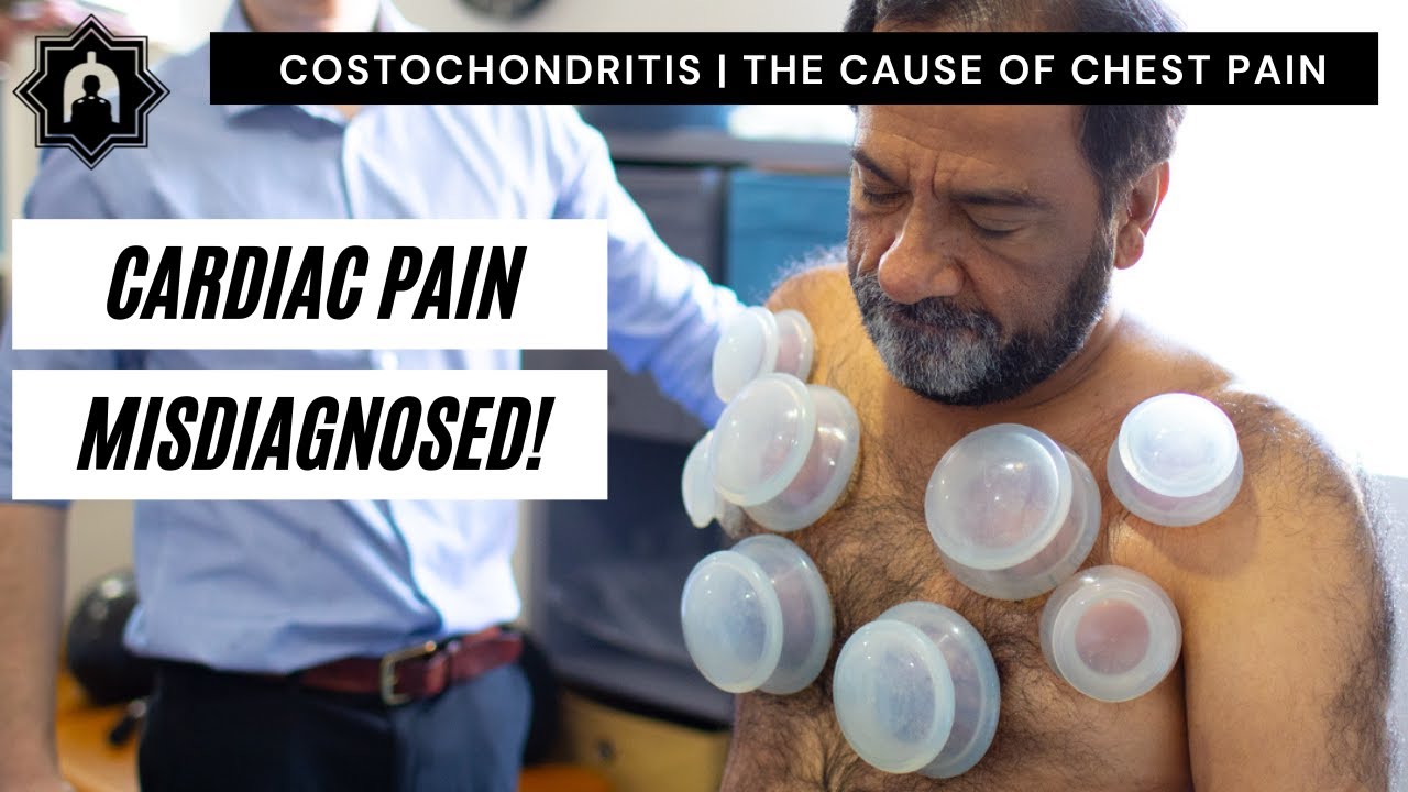 Cupping Therapy after CARDIAC PAIN? - YouTube