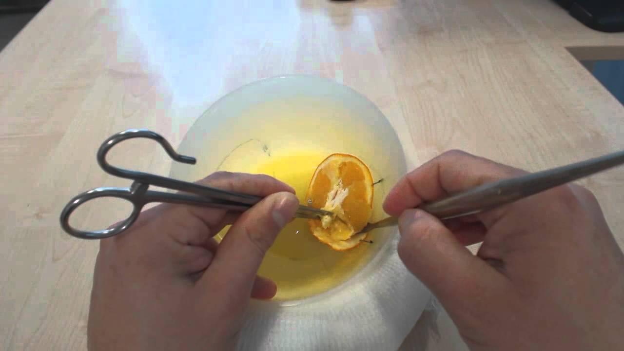 Amigdalectomía en casa/Tonsillectomy in home (The Orange Tonsillectomy ...