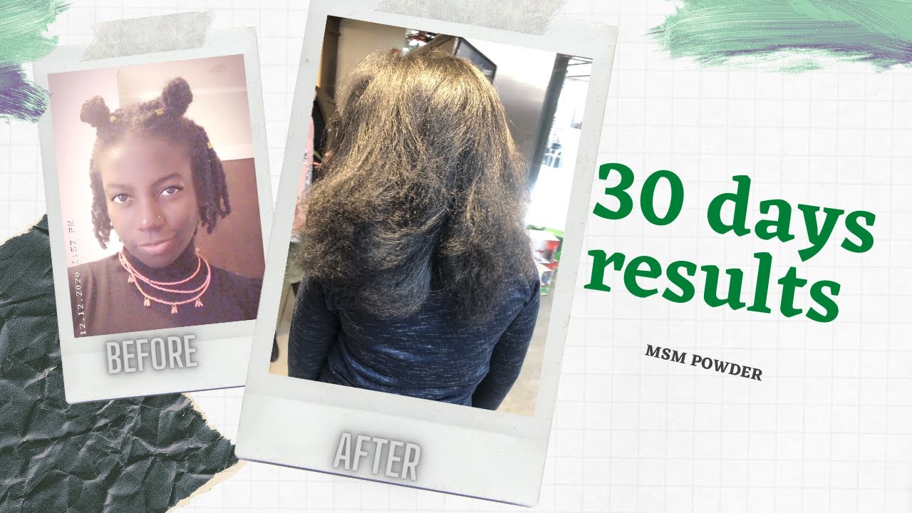 MSM results for hair growth|Prisca's Journey - YouTube