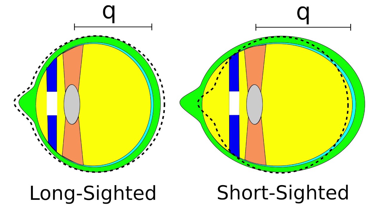 Physics Phenomena: Physics of the Human Eye - YouTube