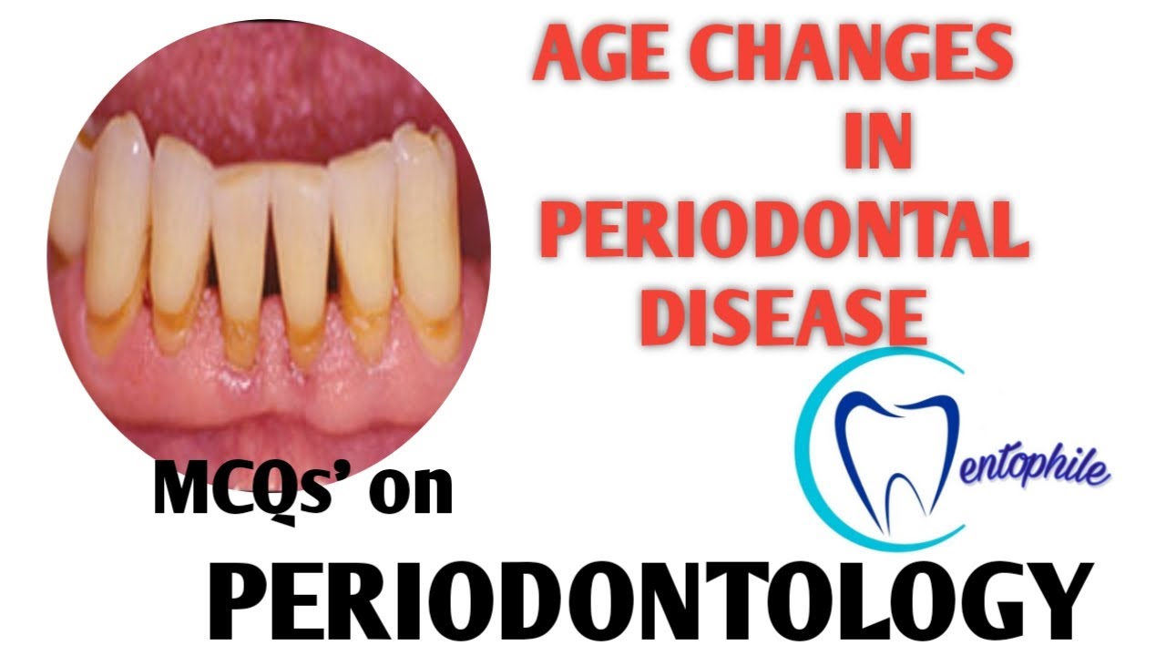 MCQs on Age Changes in Periodontal Disease || Periodontology ...