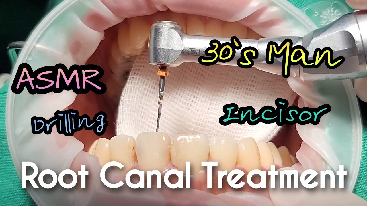 [ASMR] Root Canal Treatment #4k #dentistasmr #drilling - YouTube