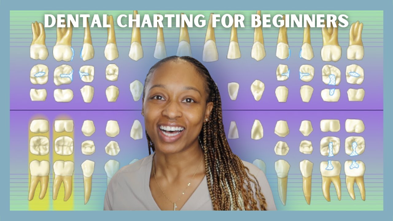 How To Read X-rays & Hard Chart Using Dentrix | BEGINNER FRIENDLY - YouTube