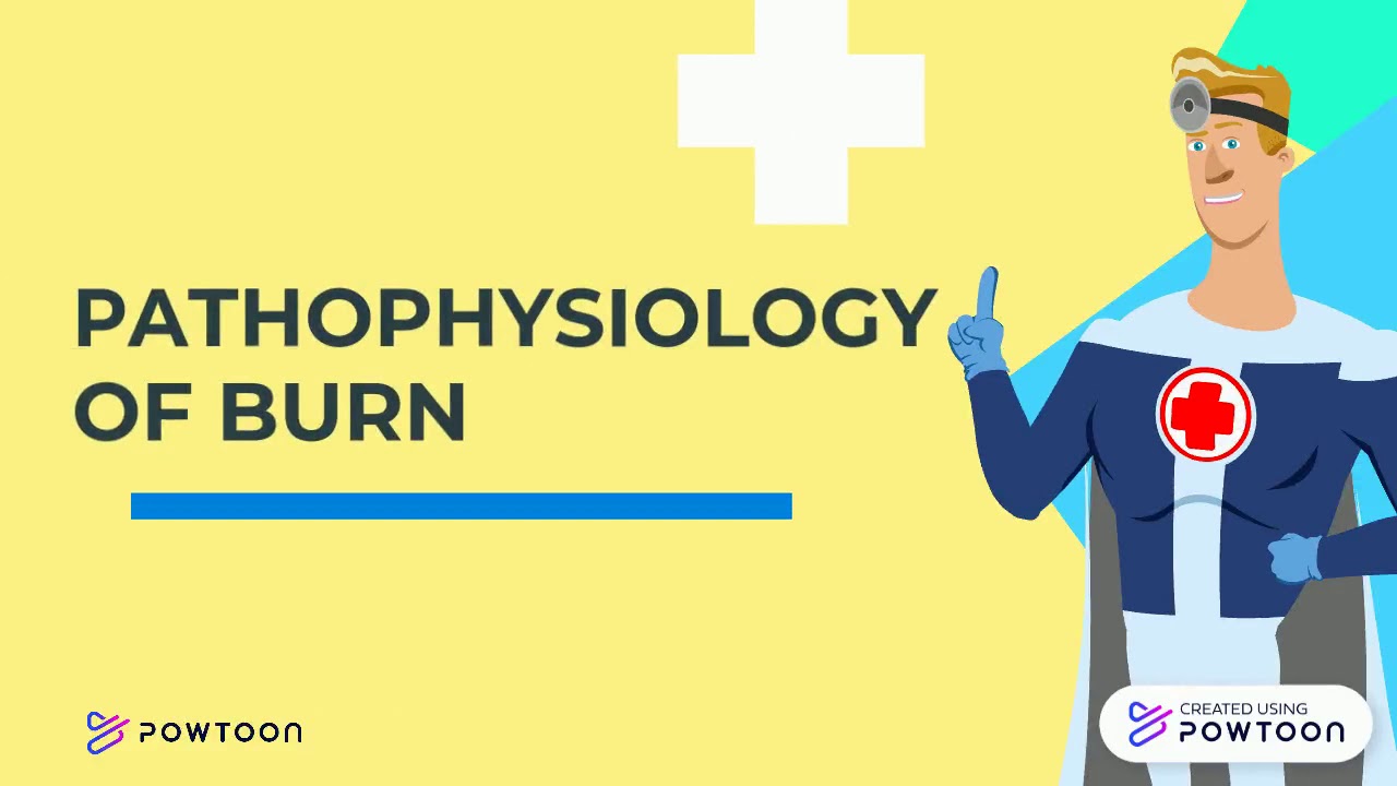 PATHOPHYSIOLOGY OF BURN - YouTube