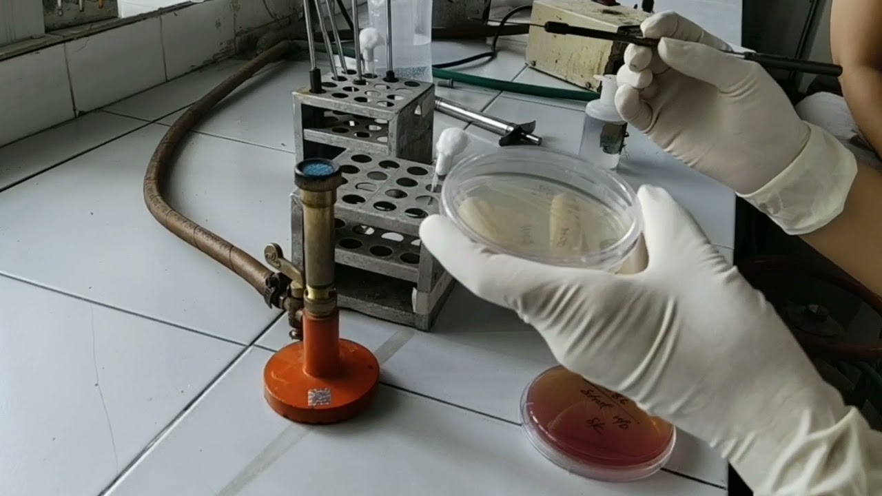Vibrio cholerae - Cholera red reaction test - YouTube