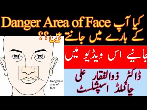 Danger Area of Face-What Precautions Needed?||Urdu| Hindi@drzulfiali # ...