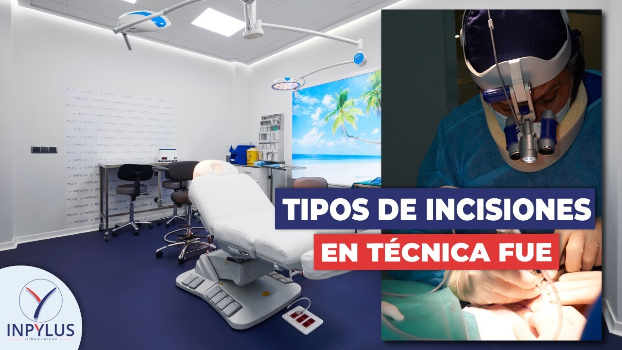 Tipos de incisiones en técnica FUE - Dr. Yane - YouTube