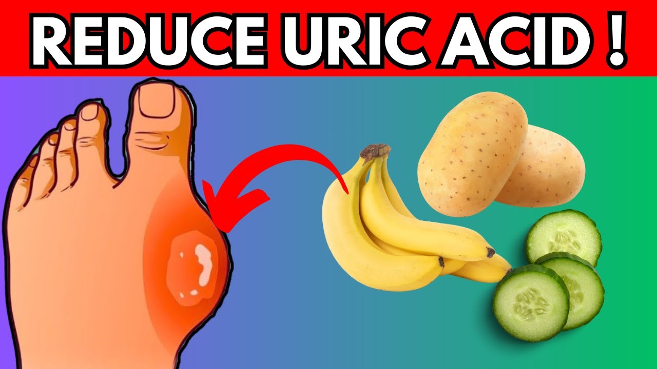 Super Foods That Reduce Uric Acid Levels Repair Kidney Health|| Healthy ...