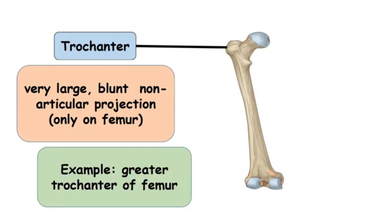 Trochanter Bone Marking - YouTube