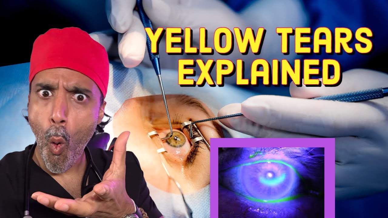 YELLOW TEAR TikTok Explained by a doctor - YouTube