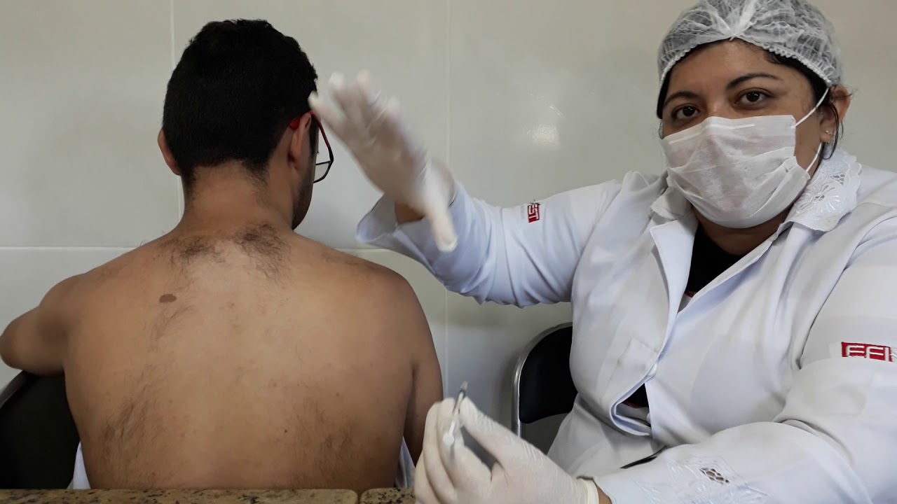 Injeção Subcutânea na Região Escapular. - YouTube