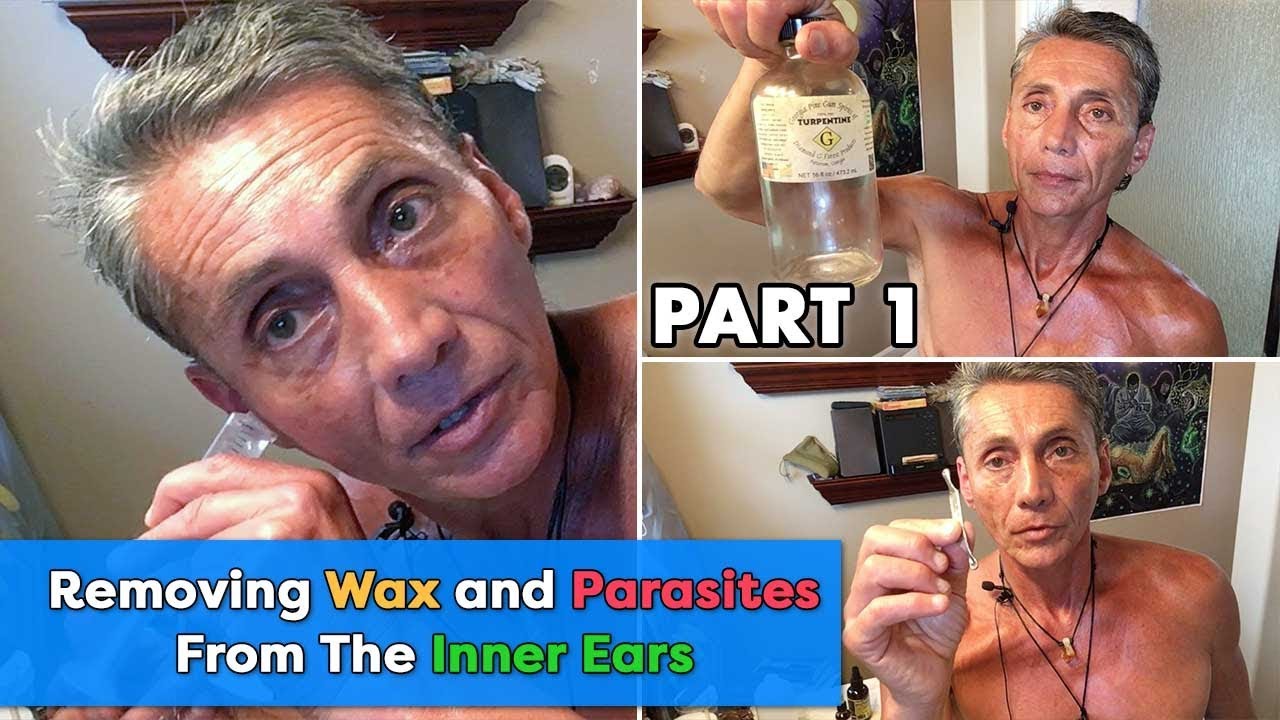 Removing Wax and Parasites From The Inner Ears Part 1 | Dr. Robert ...