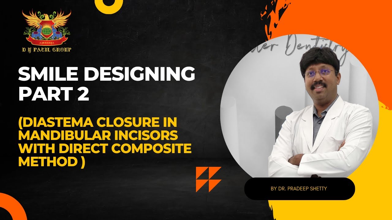 Smile Designing - Part 2 (Diastema Closure in Mandibular Incisors with ...