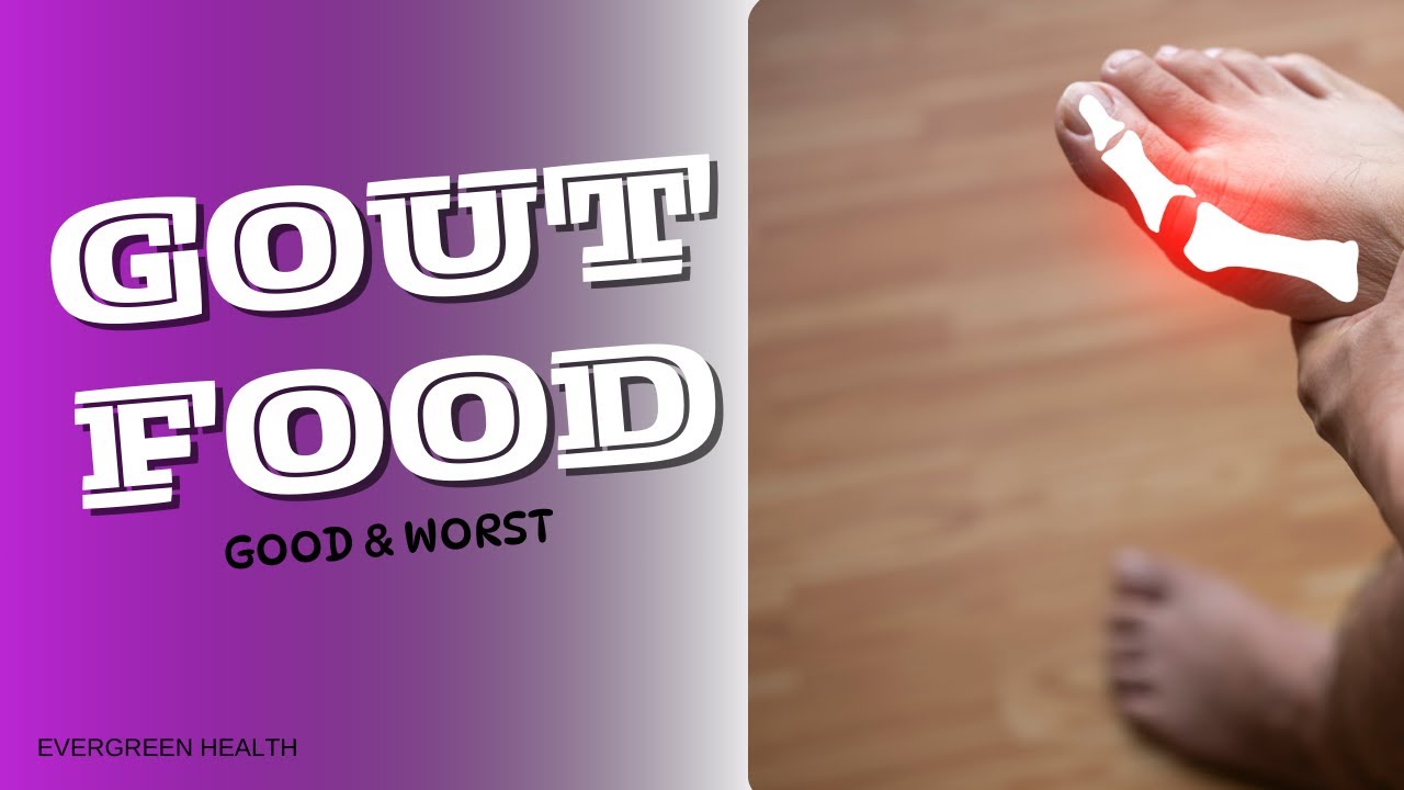 GOUT DIET |Best & Worst foods to Eat with Gout - YouTube