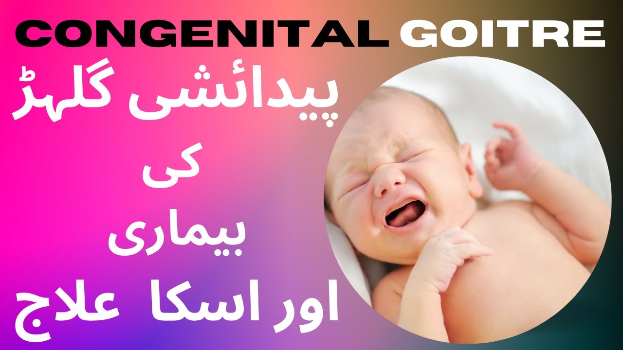 Understanding Congenital Goitre: Causes, Symptoms, and Treatment - YouTube