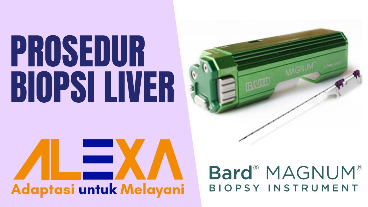 Prosedur Biopsi Liver dengan BARD Magnum Biopsy Instrument - YouTube