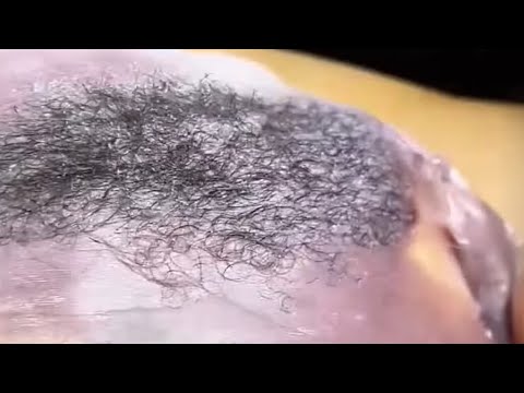 Brazilian hairy leg hard wax for beginners(42)#waxing#viral#wax#brazilian#sugaring#hardwax