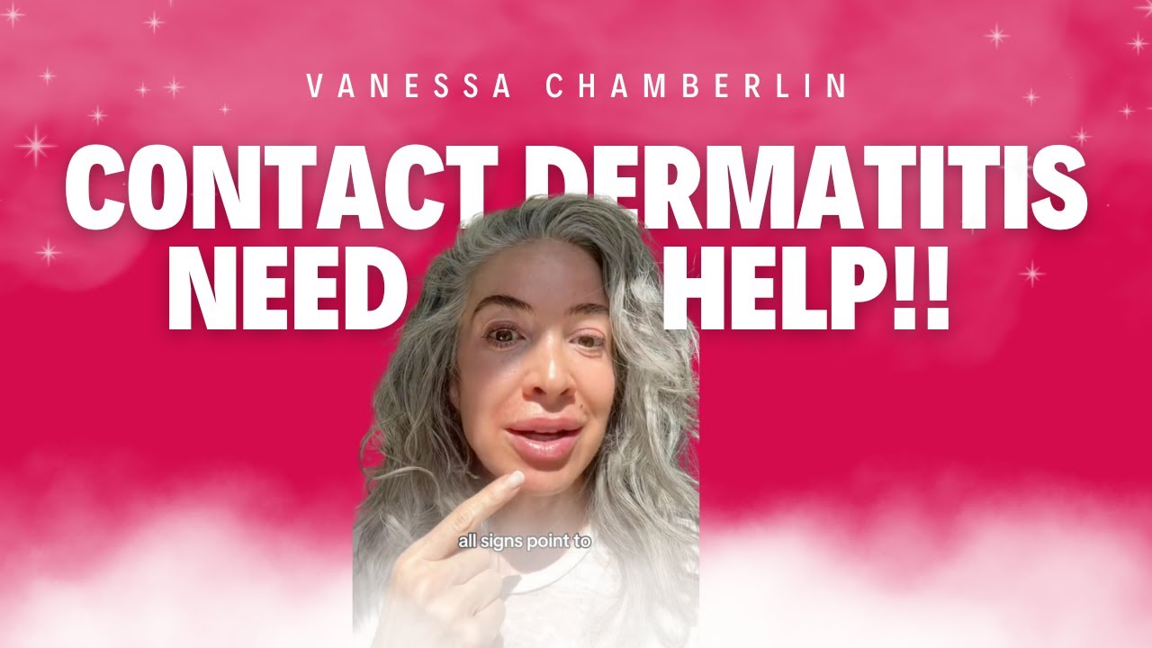 Signs of contact dermatitis | I need help - YouTube