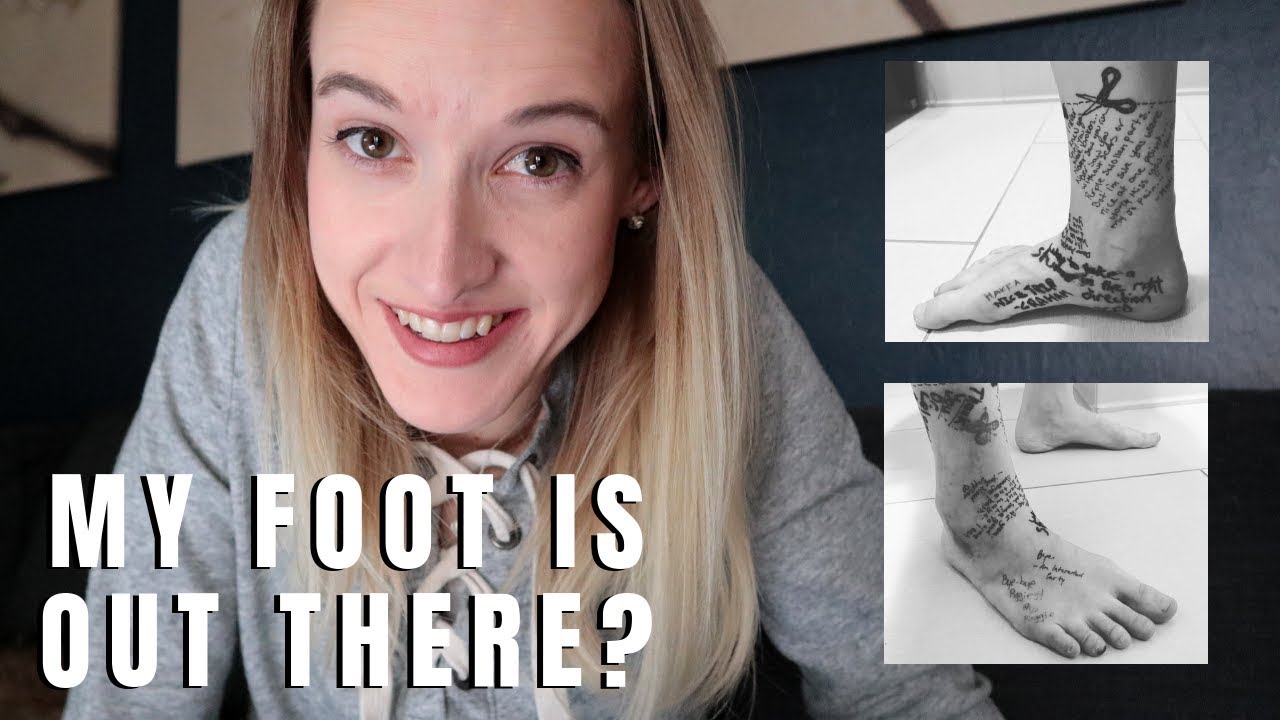 MY AMPUTATED FOOT - Photos Are Out There?? - YouTube
