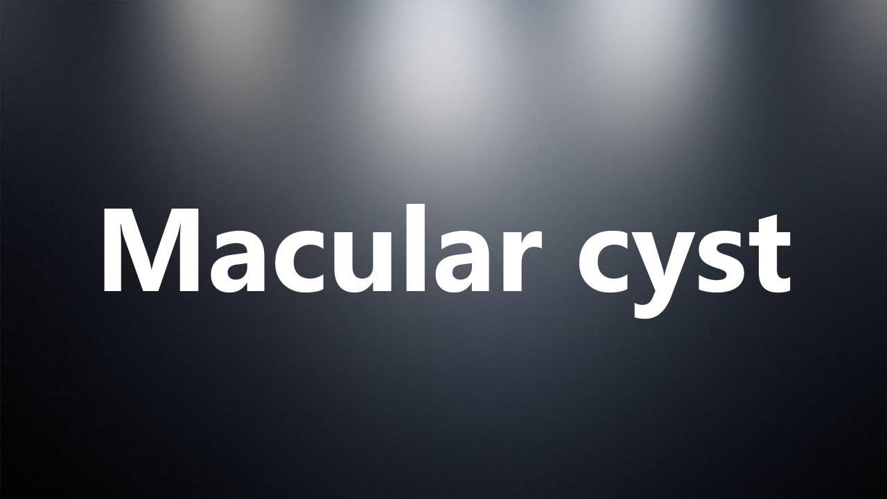 Macular cyst - Medical Meaning and Pronunciation - YouTube