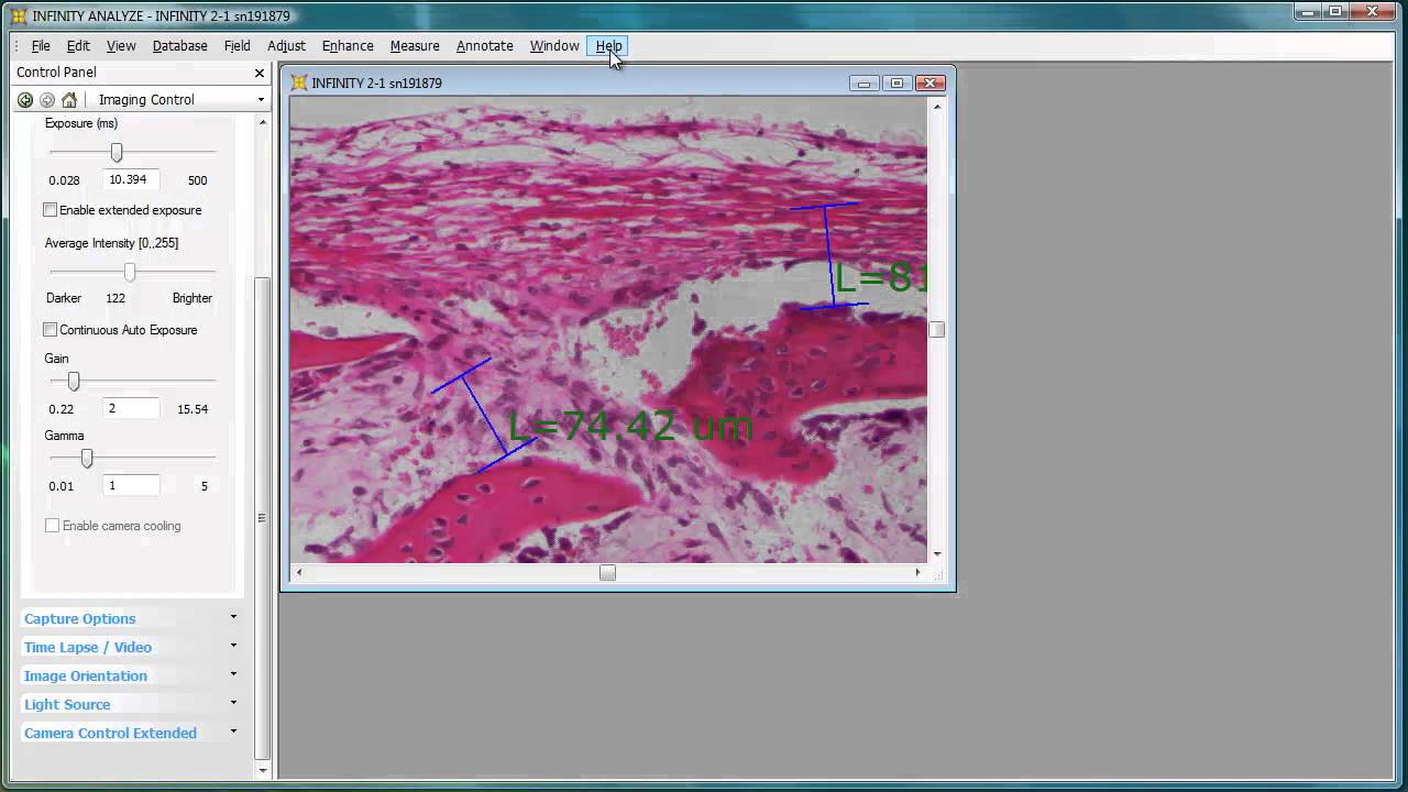 INFINITY ANALYZE QUICK TIP: Measurement on live preview (Software ...