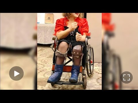 The beautiful woman has polio. The challenge of disability and polio # ...
