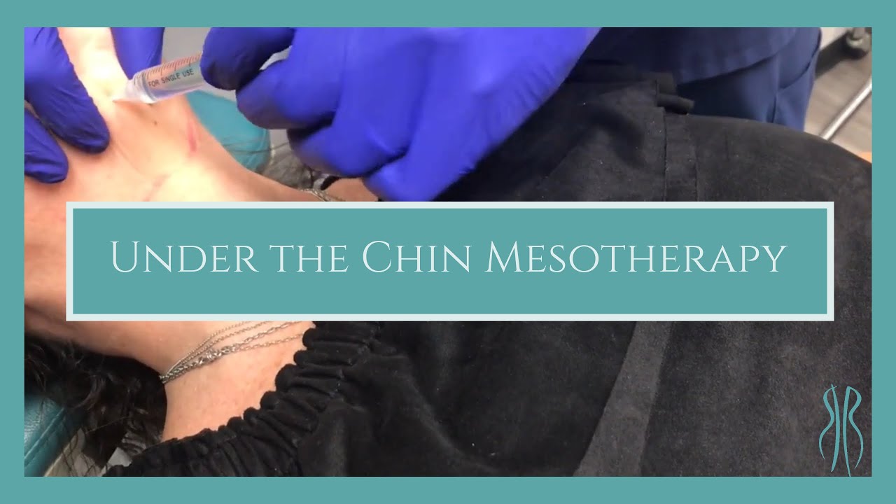 Under the Chin Mesotherapy for Fat Loss - YouTube
