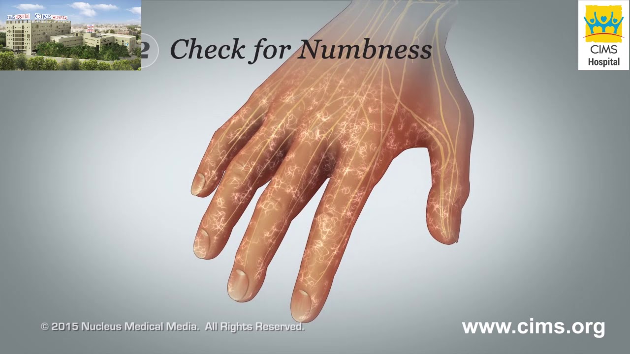 Circulation Checks_ Upper Extremity – CIMS Hospital - YouTube