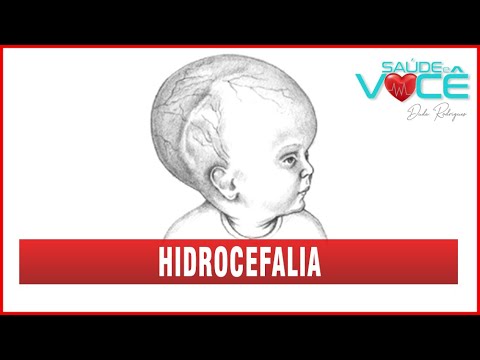 Dr. César Cimonari - Hidrocefalia - YouTube
