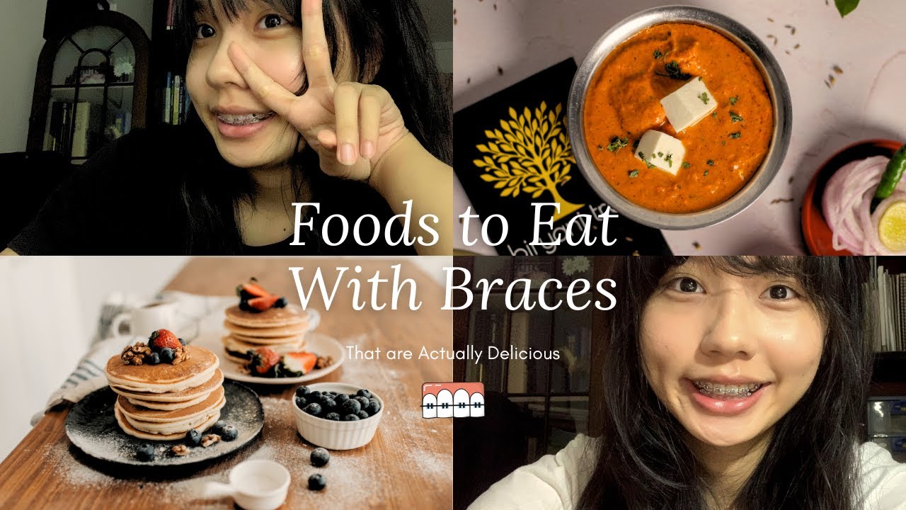 What I ate with braces (actual delicious food) - YouTube