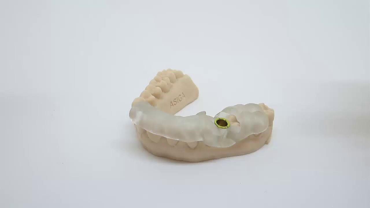 Asiga DentaMODEL with Surgical Guide - YouTube