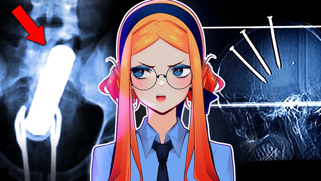 15 Most UNSETTLING X-Rays Ever Taken - YouTube