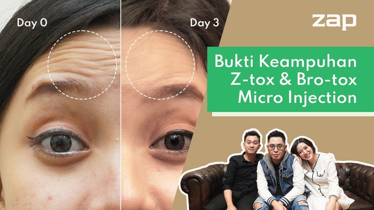 BUKTIKAN KEAMPUHAN TREATMENT Z-TOX MICRO INJECTION! KURANGI KERUTAN ...