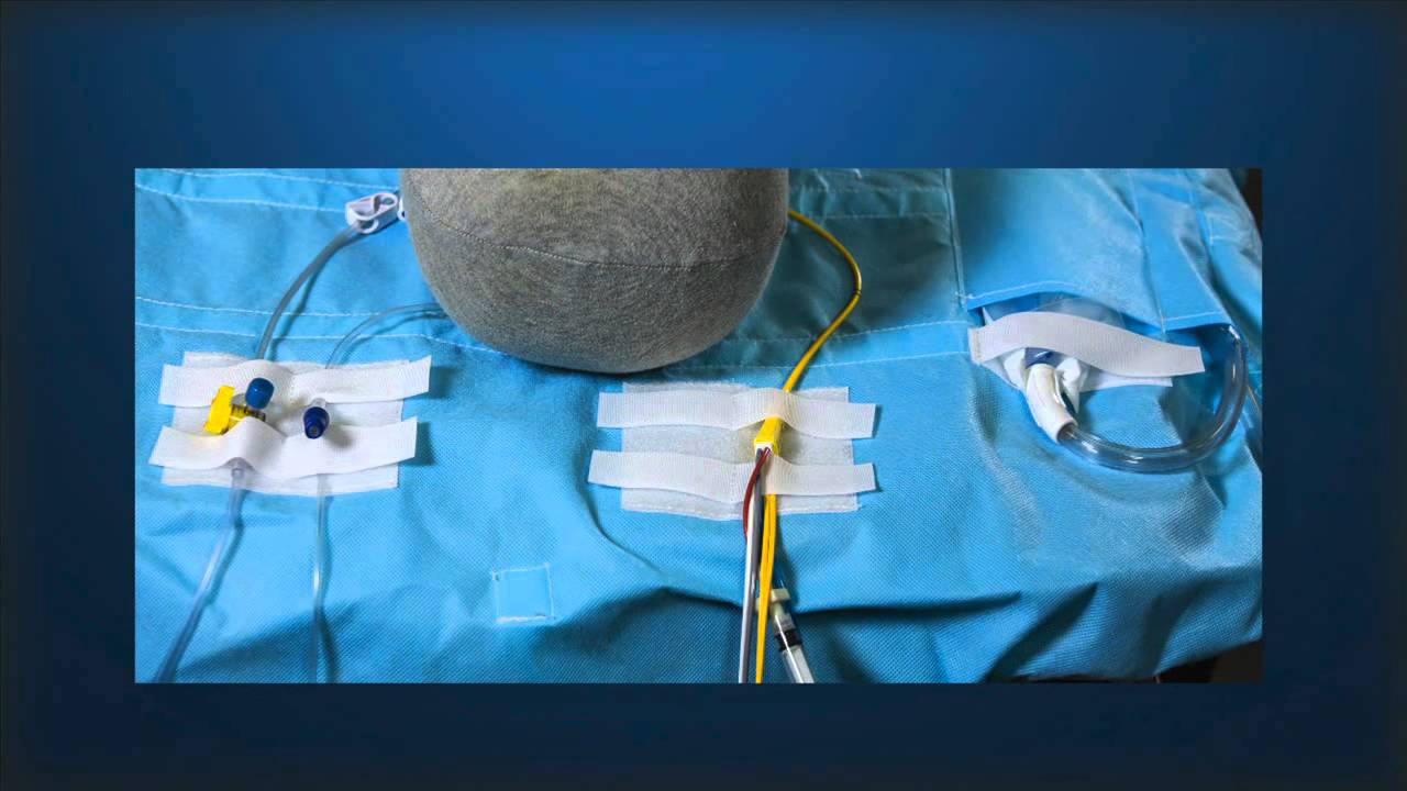 Opt-Shield™ Supine Video - YouTube